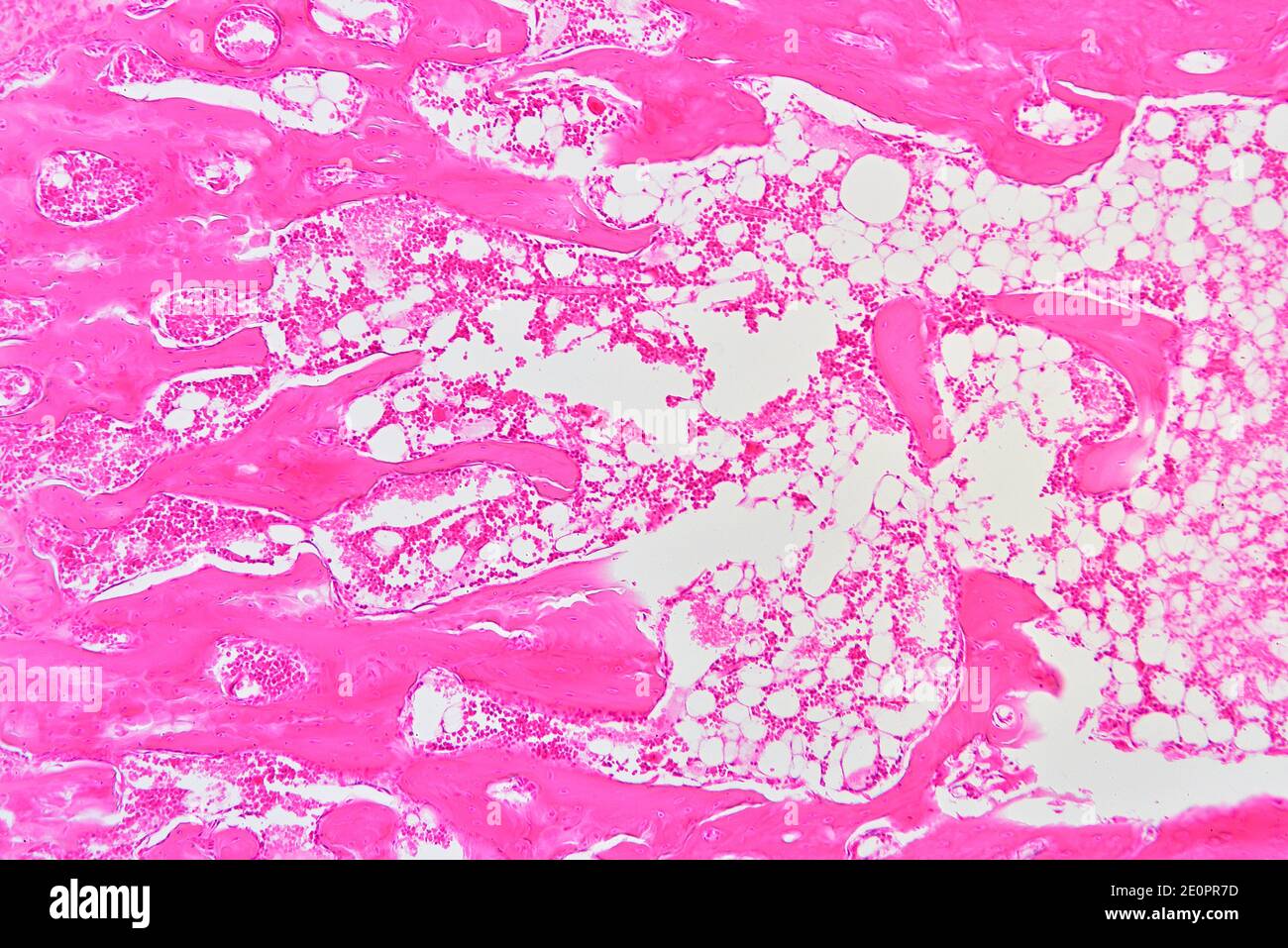 Human bone longitudinal Banque de photographies et d’images à haute ...