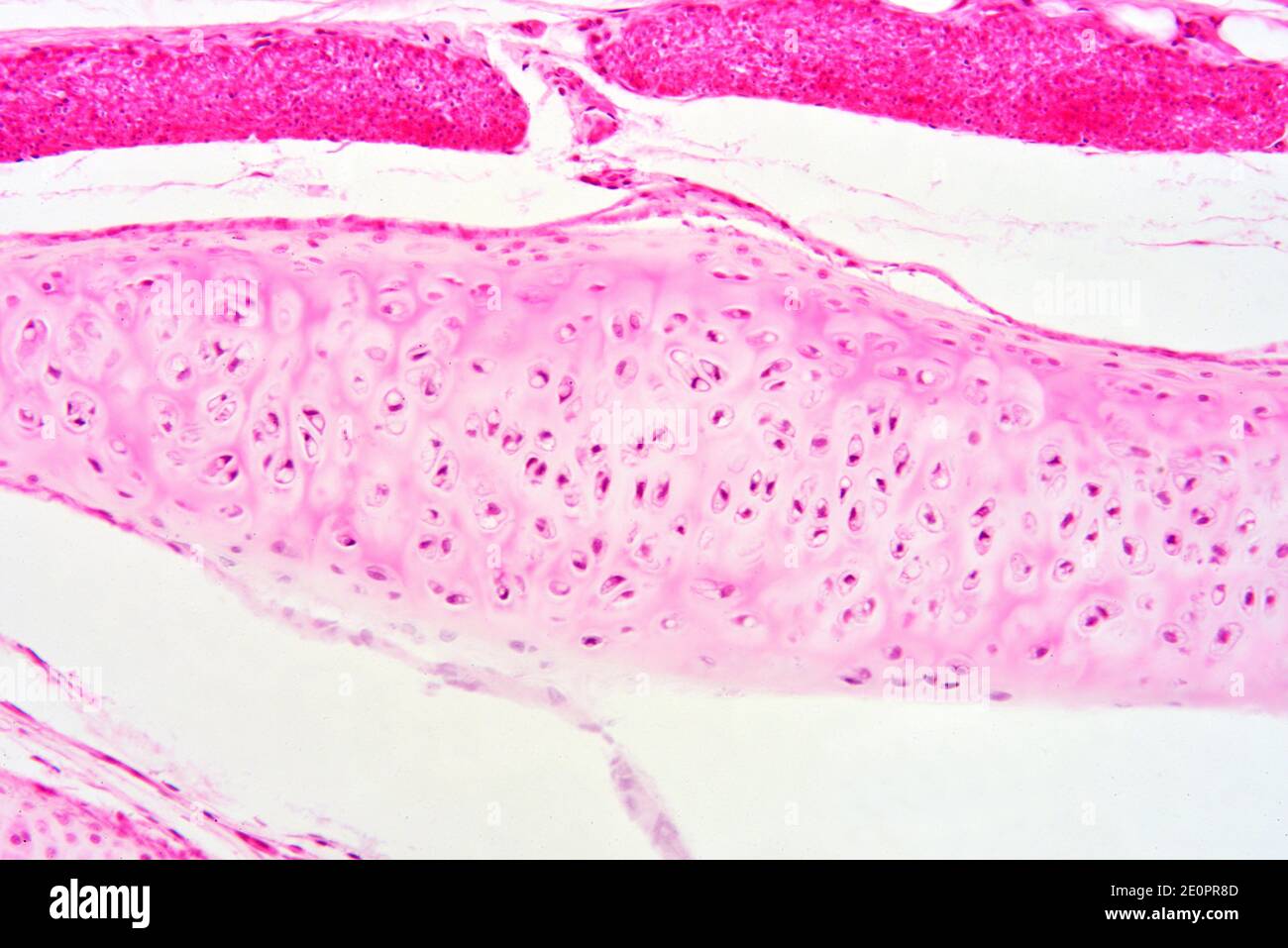 La trachée Banque de photographies et d’images à haute résolution - Alamy