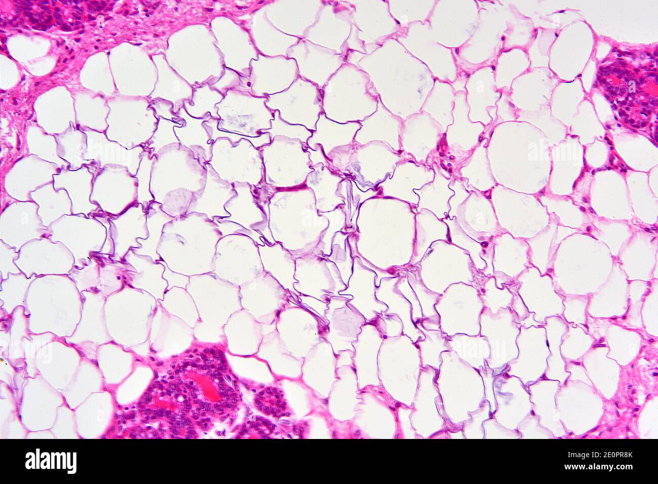 Adipose tissue Banque de photographies et d’images à haute résolution ...