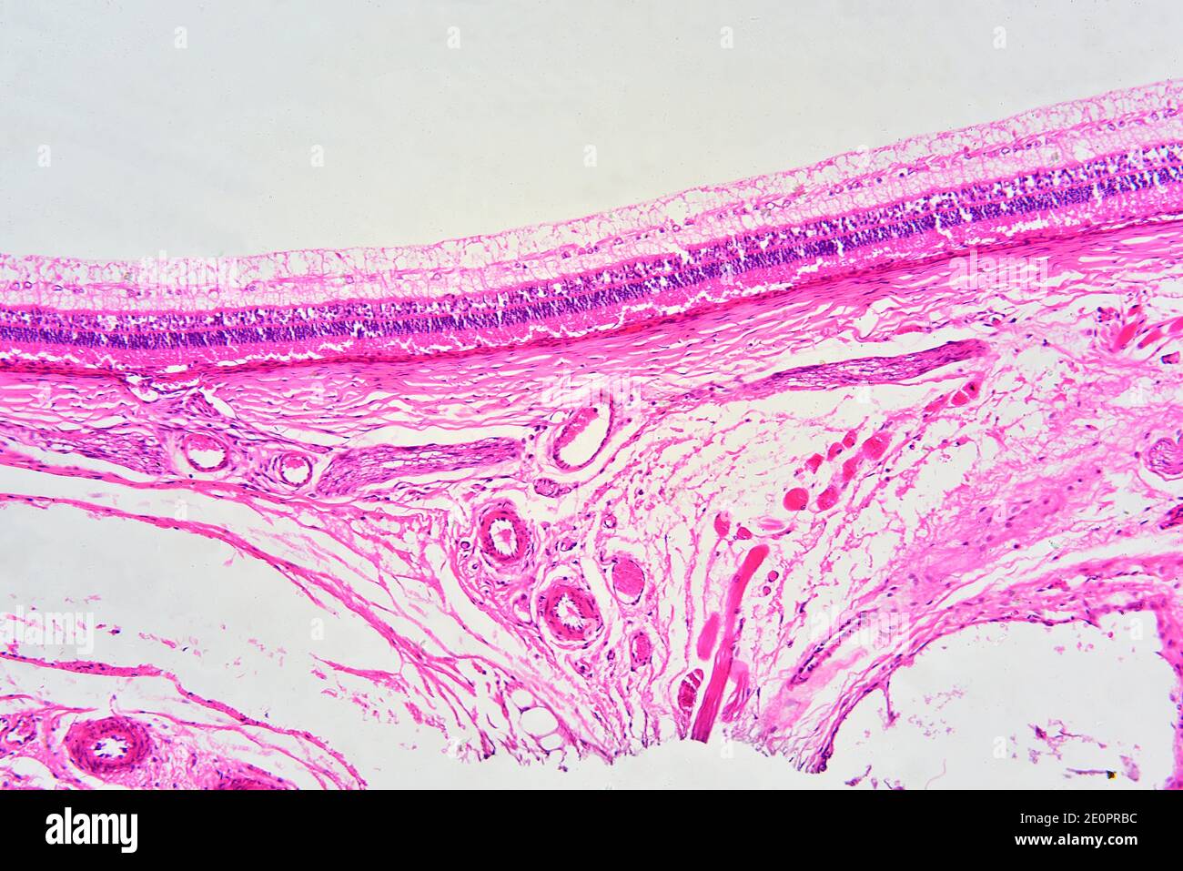 Vaisseaux sanguins oculaires Banque de photographies et d’images à ...