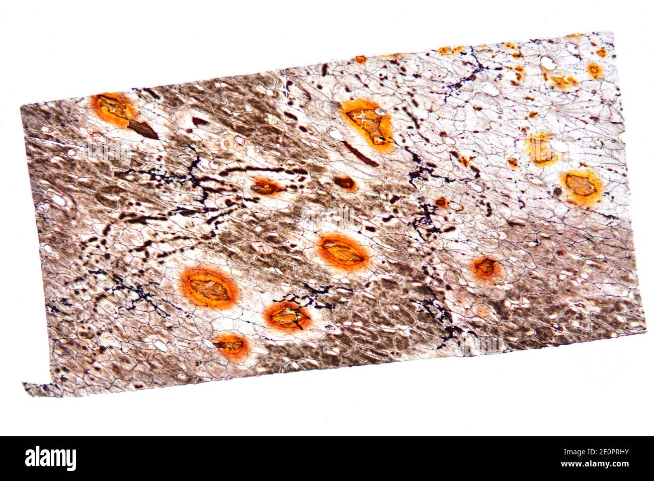 Simple Squamous Epithelium Banque d'images détourées - Alamy