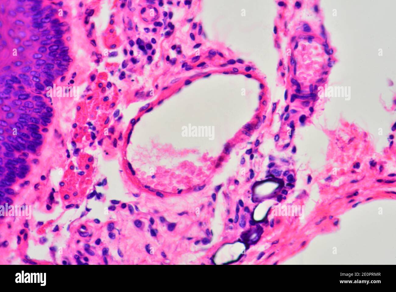 Microphotographie Veine Banque d'image et photos - Alamy