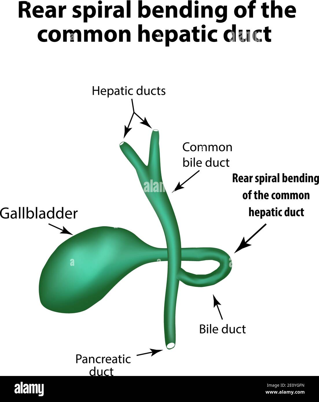 Cystic duct common hepatic Banque de photographies et d’images à haute ...