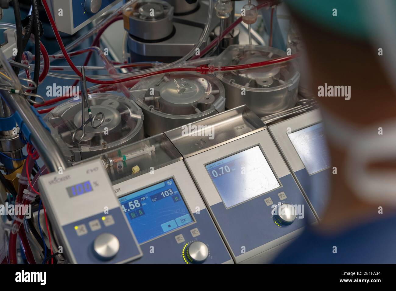 Circulation extracorporelle Banque de photographies et d’images à haute ...