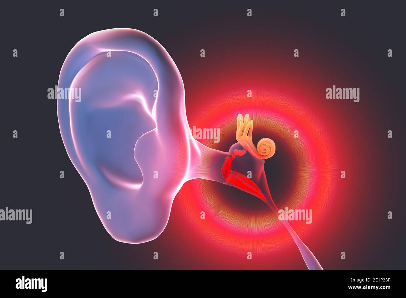 Ear Infection Banque d'image et photos - Alamy