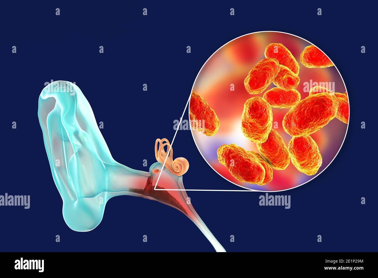 Ear infection Banque de photographies et d’images à haute résolution ...