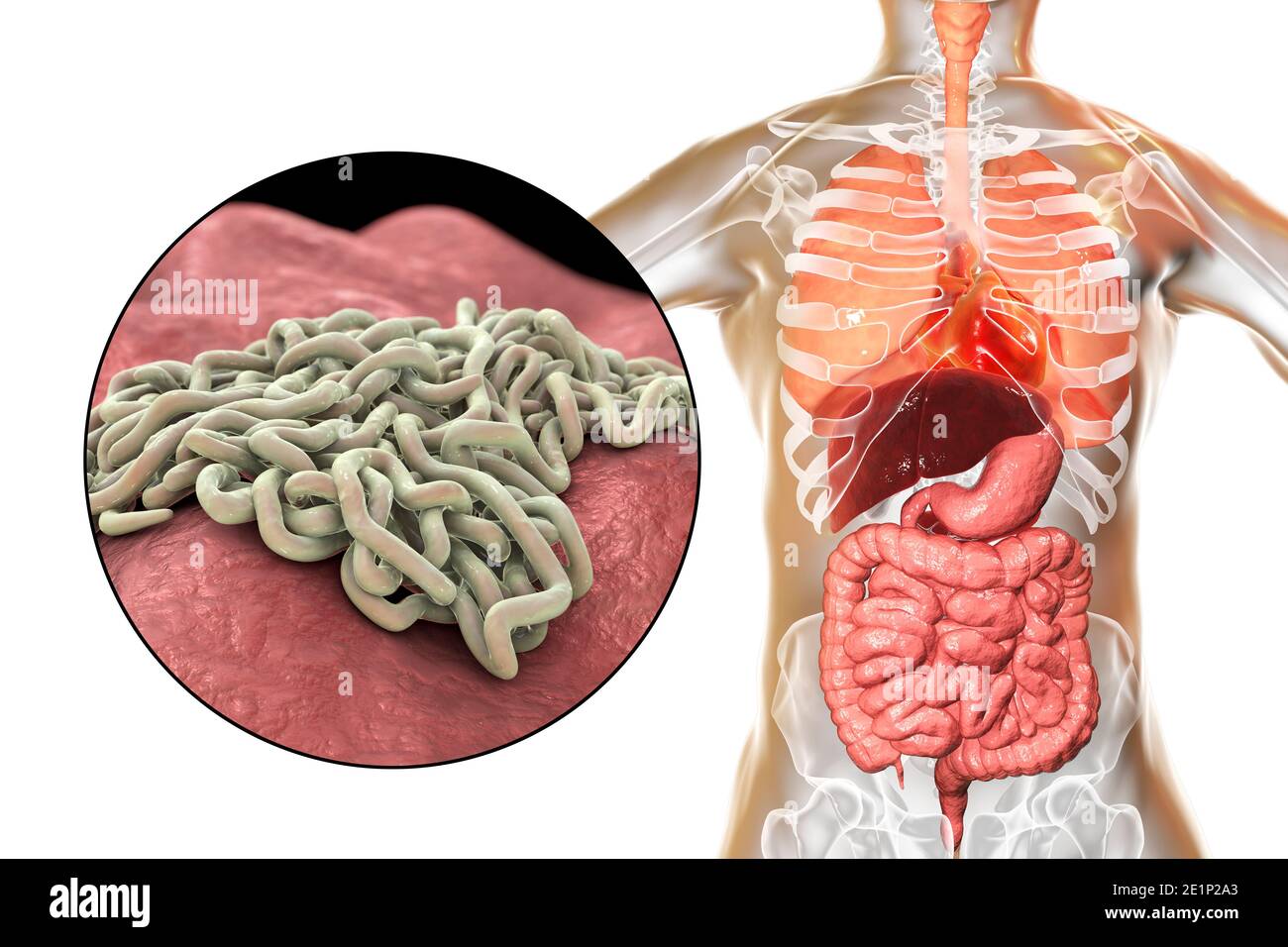 Vers intestinaux humain ronds Banque de photographies et d’images à ...