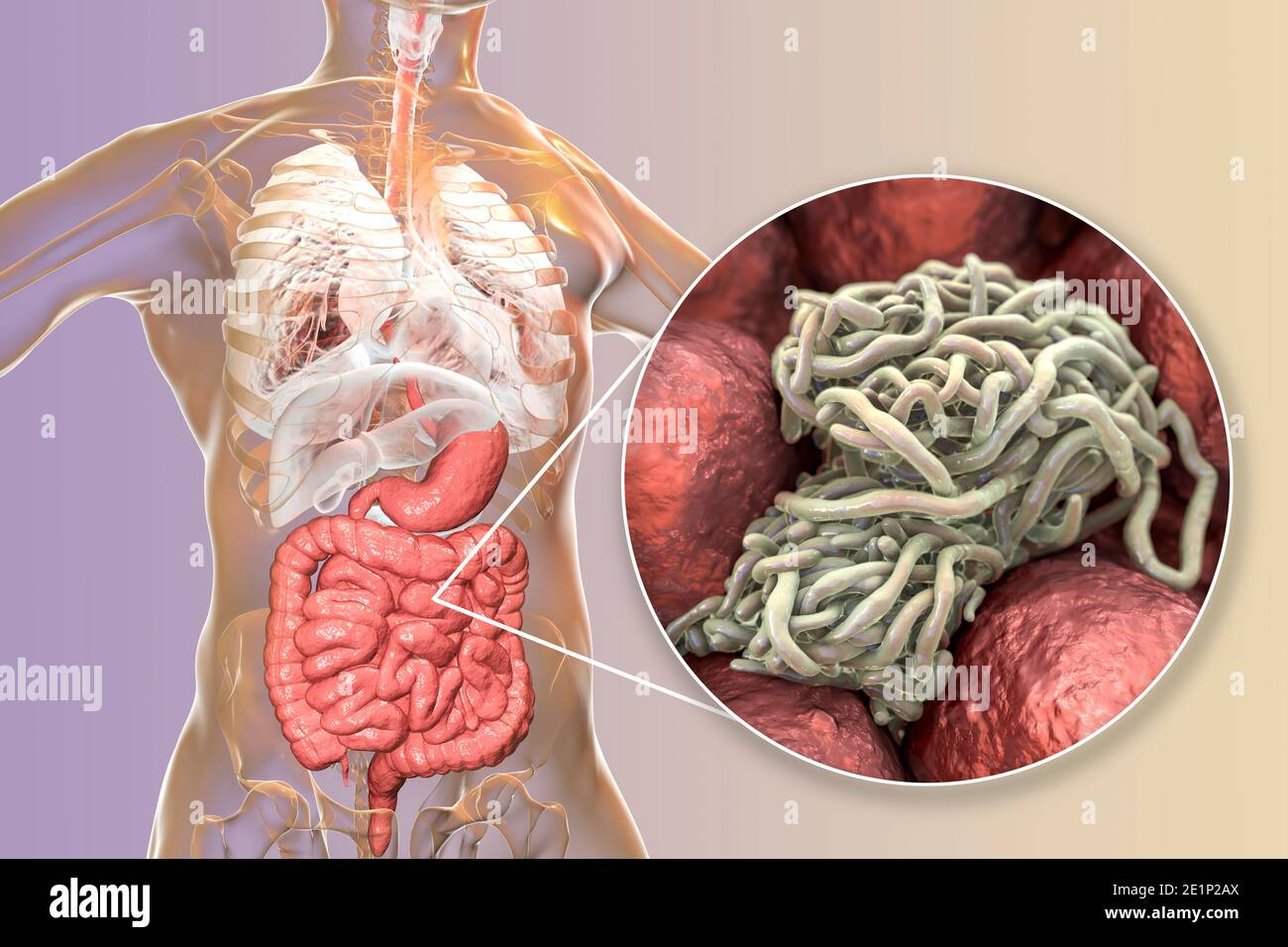 Vers Intestinaux Banque d'image et photos - Alamy
