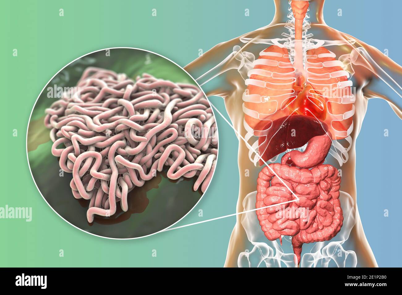 Oxyure humaine Banque de photographies et d’images à haute résolution ...