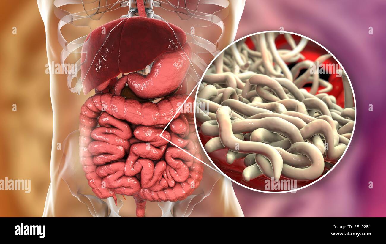 Vers intestinaux humain ronds Banque de photographies et d’images à ...