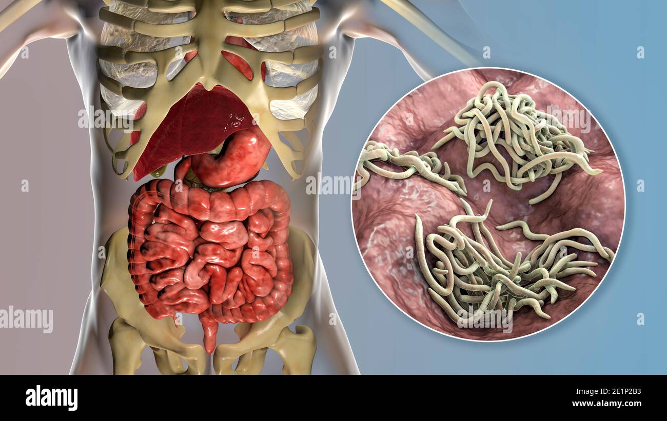 Vers intestinaux humain ronds Banque de photographies et d’images à ...