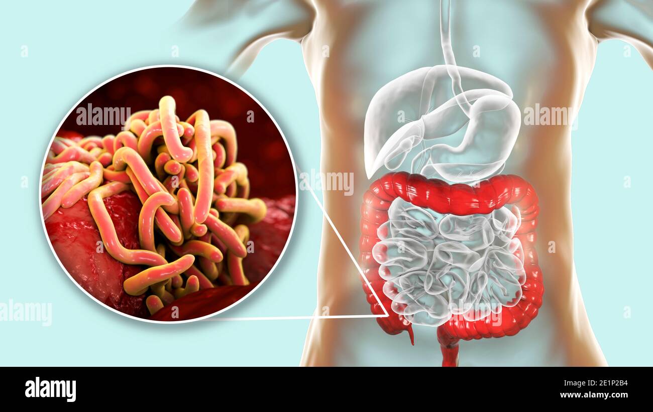 Vers intestinaux humain ronds Banque de photographies et d’images à ...