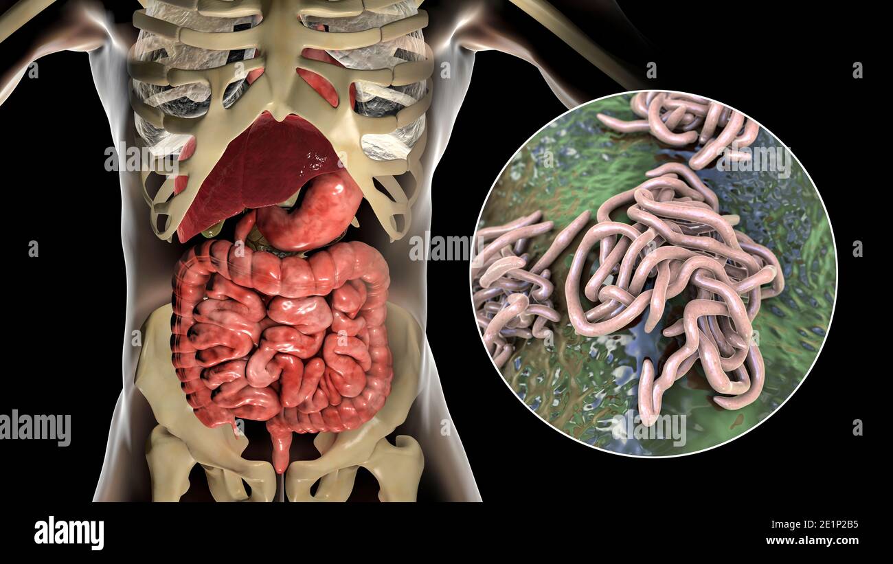 Ascaris vermicularis Banque de photographies et d’images à haute ...