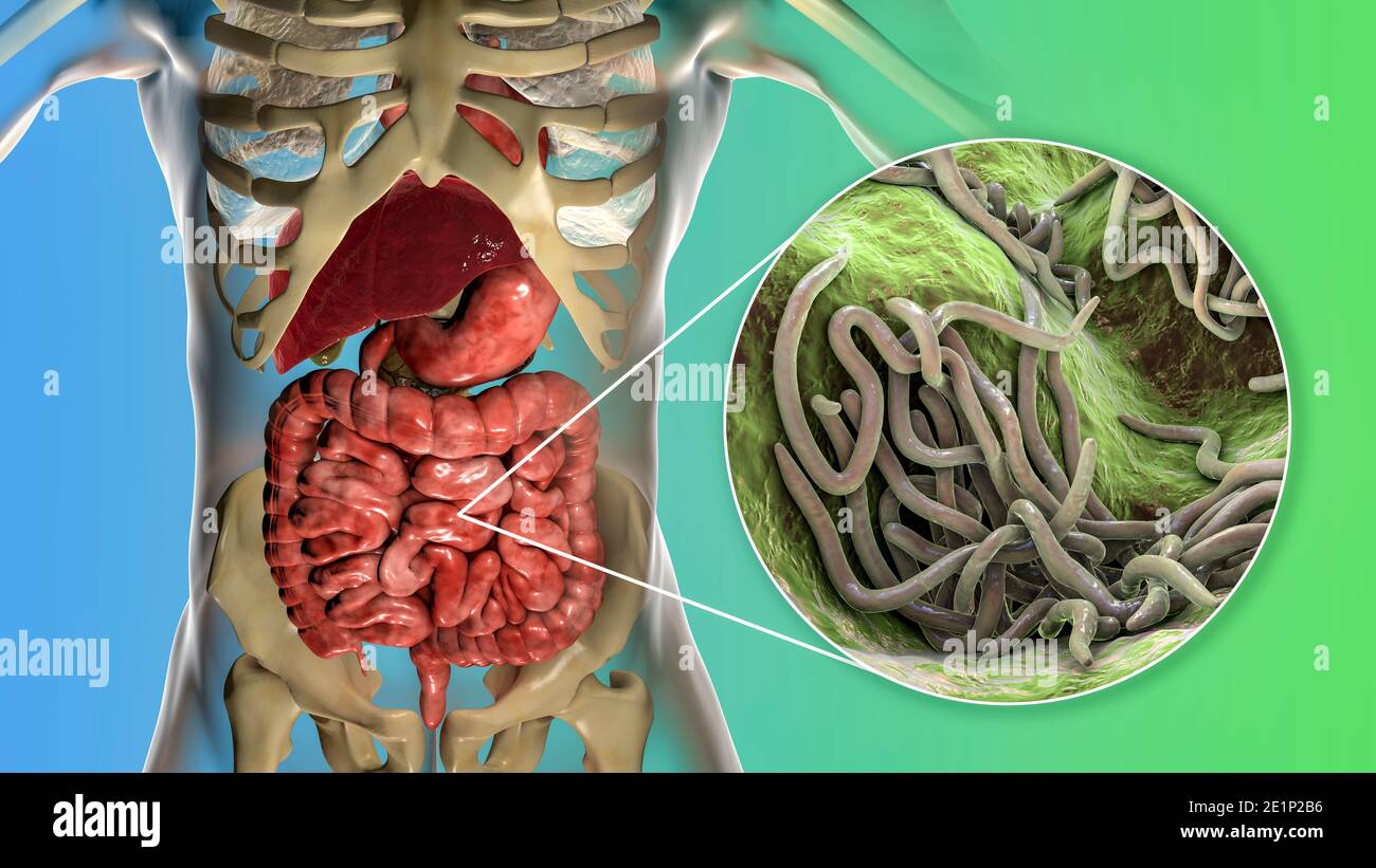 Vers intestinaux humain ronds Banque de photographies et d’images à ...