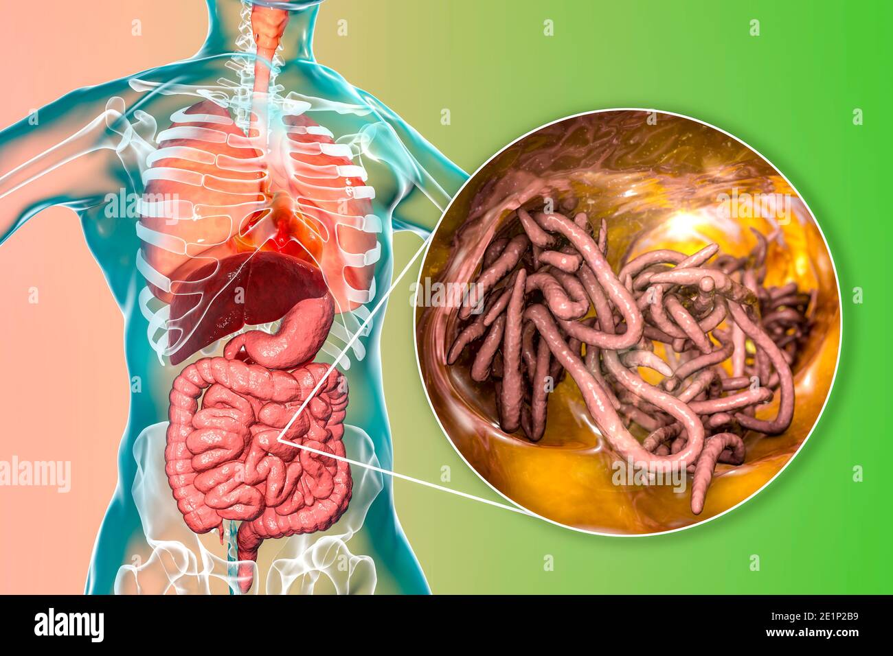 Vers intestinaux humain ronds Banque de photographies et d’images à ...