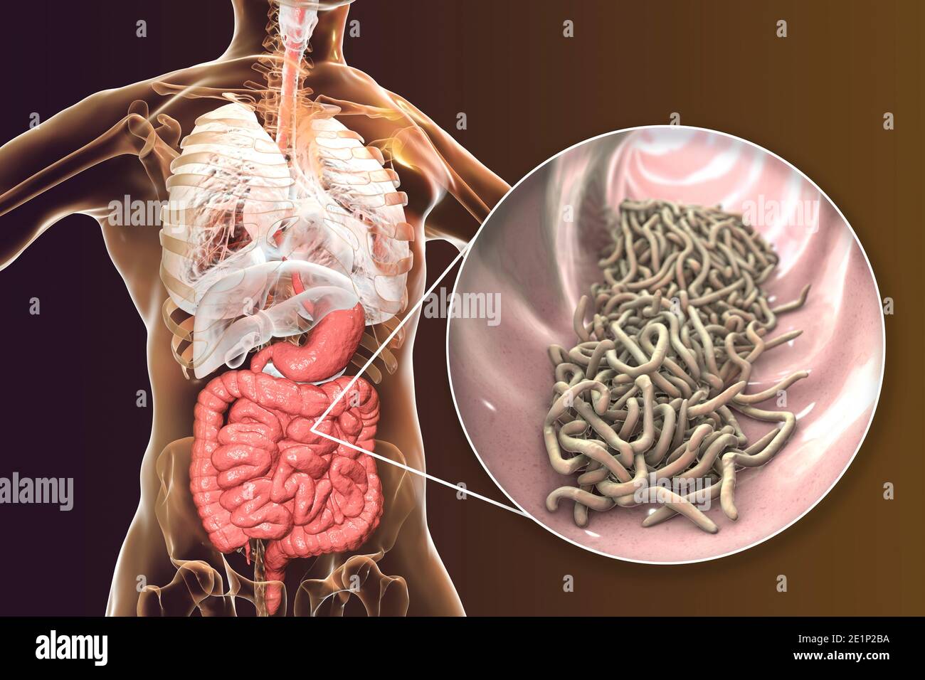 Vers intestinaux humain ronds Banque de photographies et d’images à ...