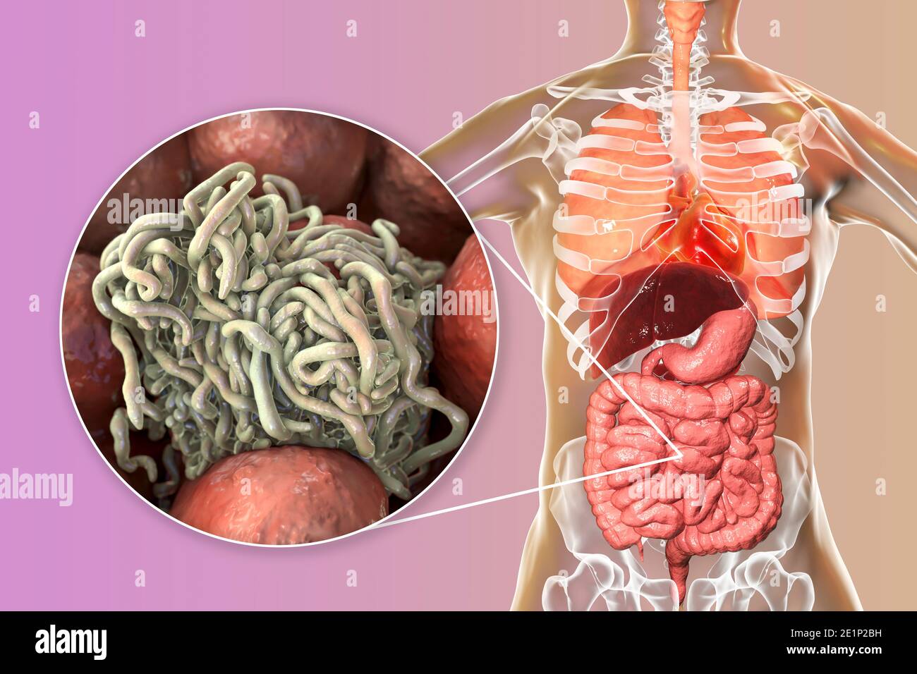 Vers intestinaux humain ronds Banque de photographies et d’images à ...