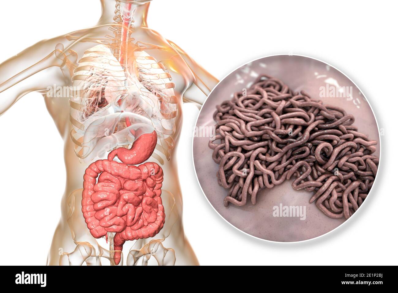 Vers intestinaux humain ronds Banque de photographies et d’images à ...