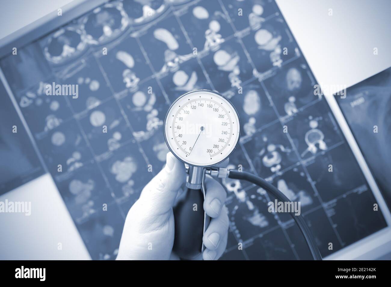 Ct scan hand Banque de photographies et d’images à haute résolution - Alamy