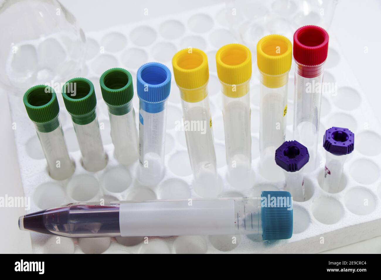 Prise de vue à angle élevé des tubes à essai dans un récipient sur la ...