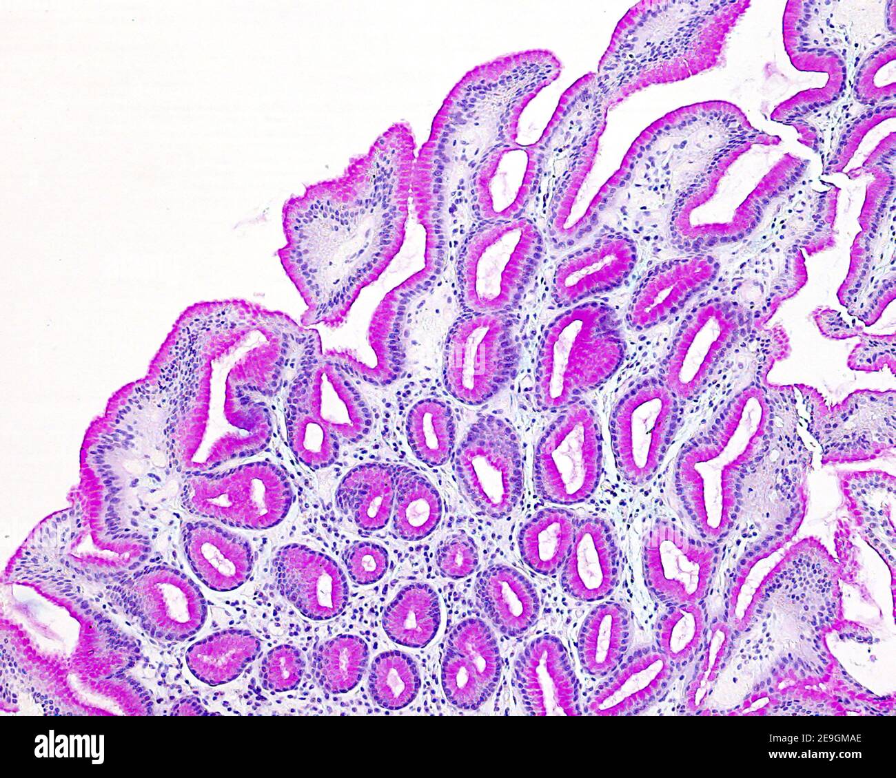Épithélium de surface recouvrant la muqueuse gastrique présentant une ...