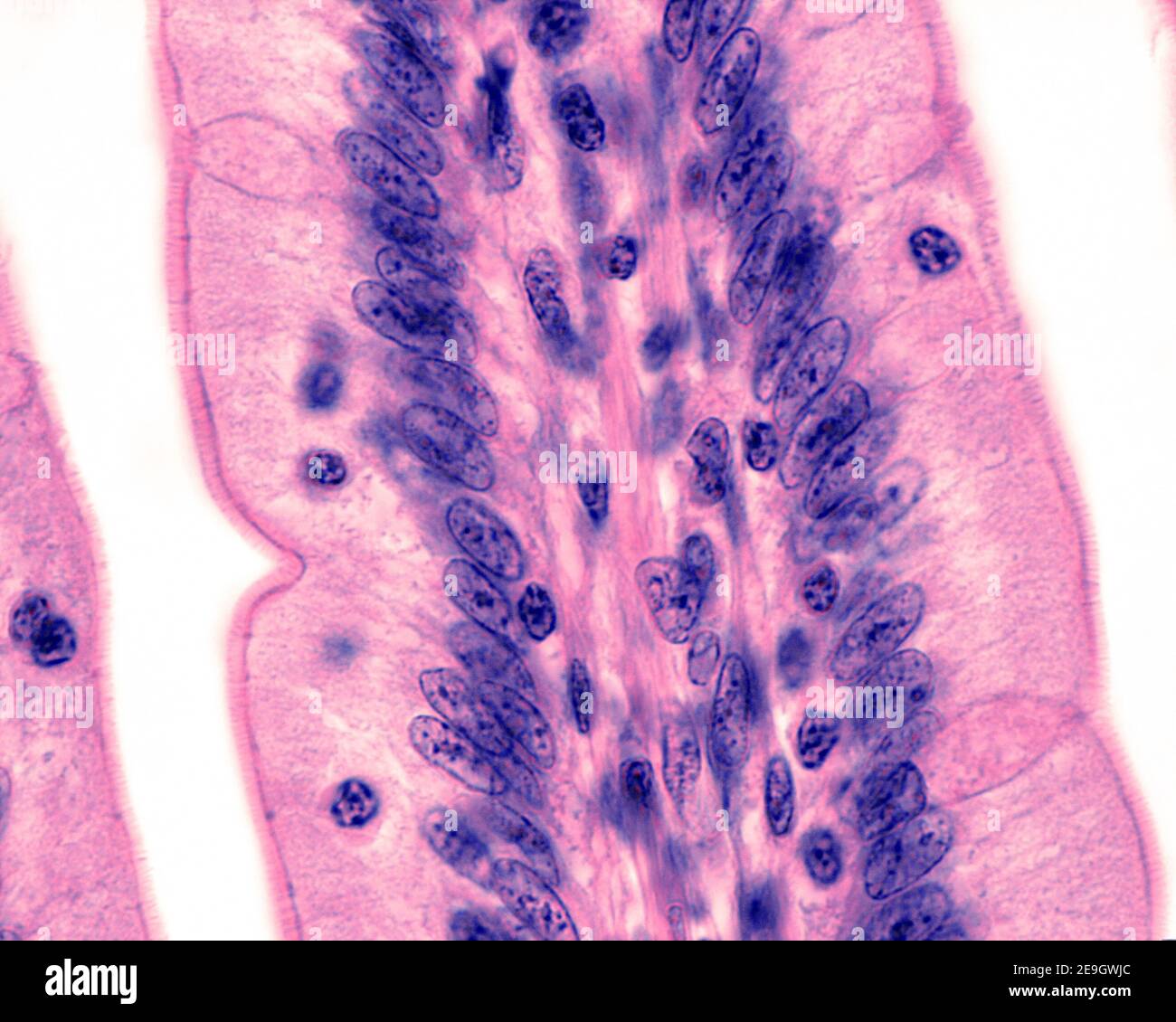 Villosités intestinales dans la section longitudinale, bordées par un ...