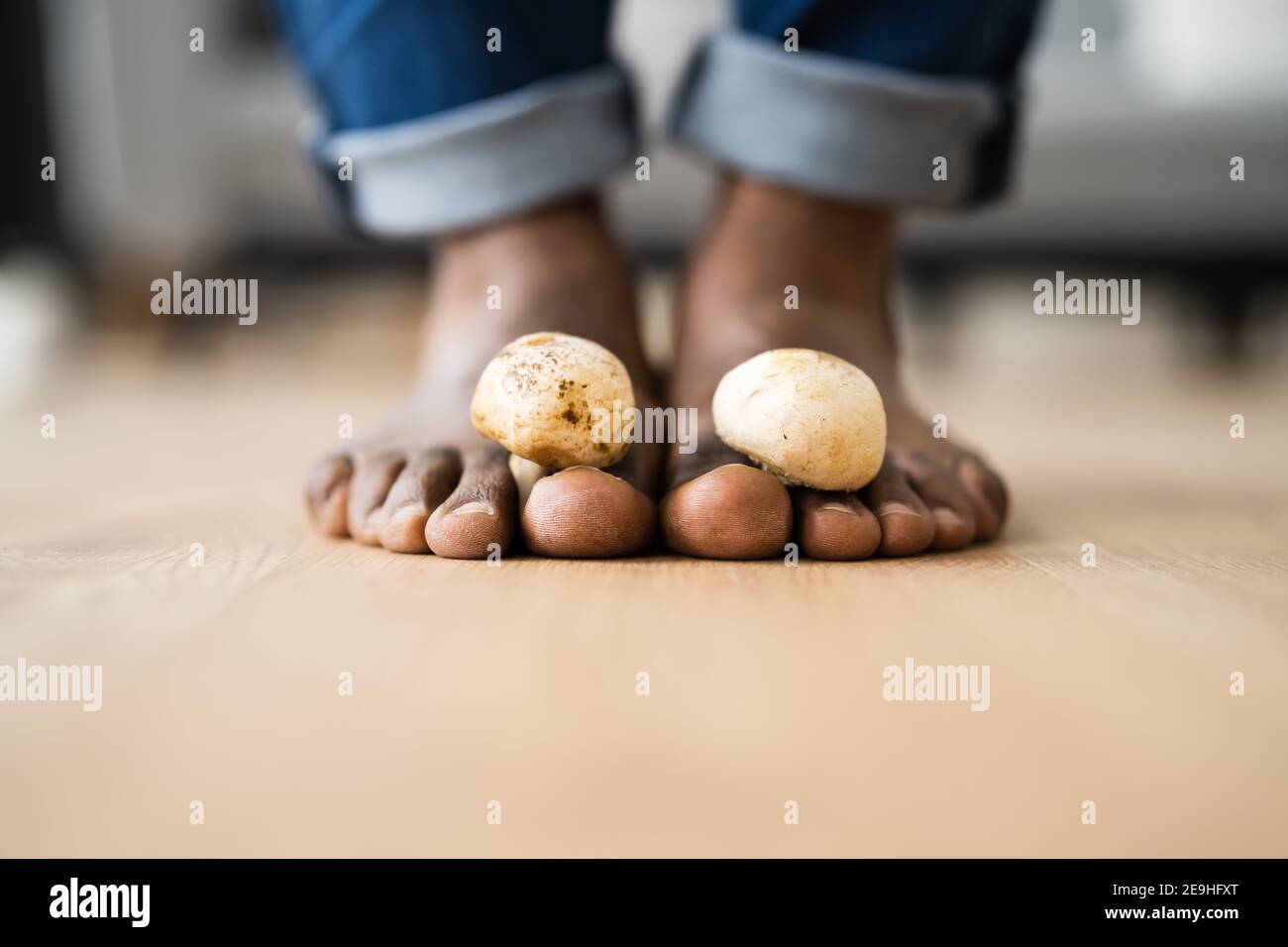 Champignon entre les orteils Banque de photographies et d’images à ...