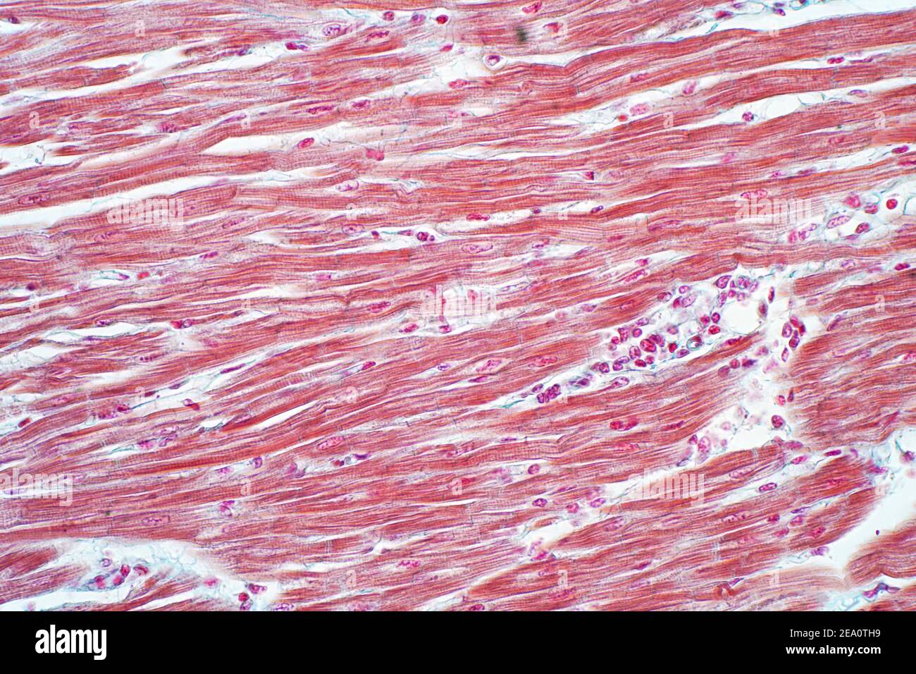 Fibres musculaires cardiaques Banque de photographies et d’images à ...