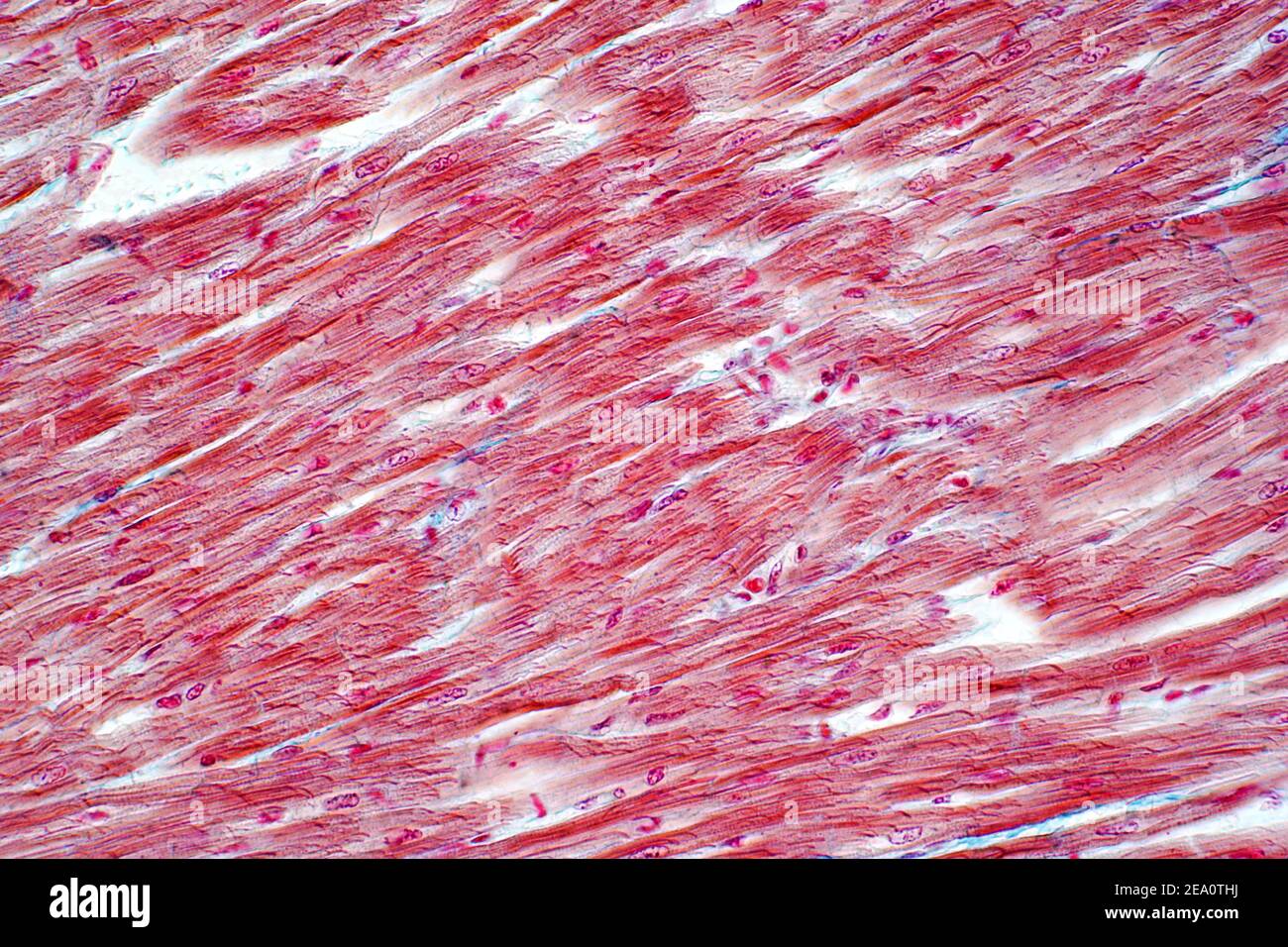 Fibres musculaires cardiaques Banque de photographies et d’images à ...