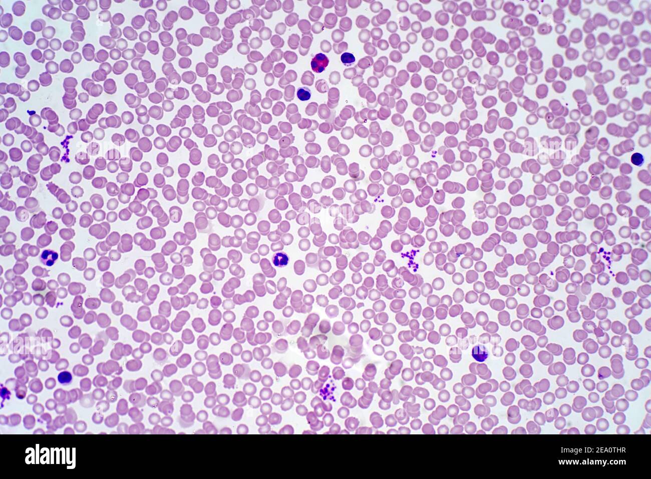 Light micrograph red blood cells Banque de photographies et d’images à ...