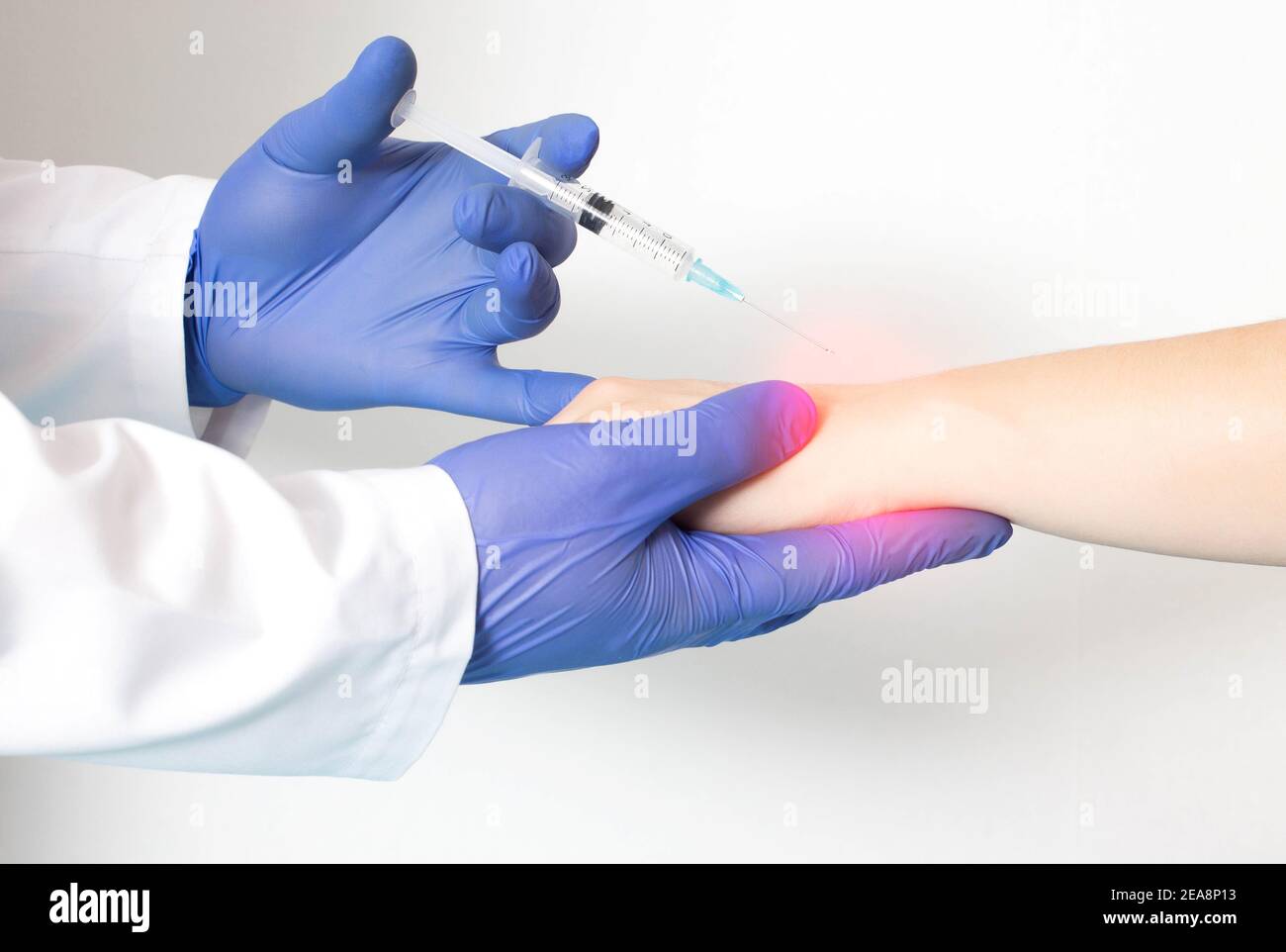 Injection de corticoide articulaire Banque de photographies et d’images ...