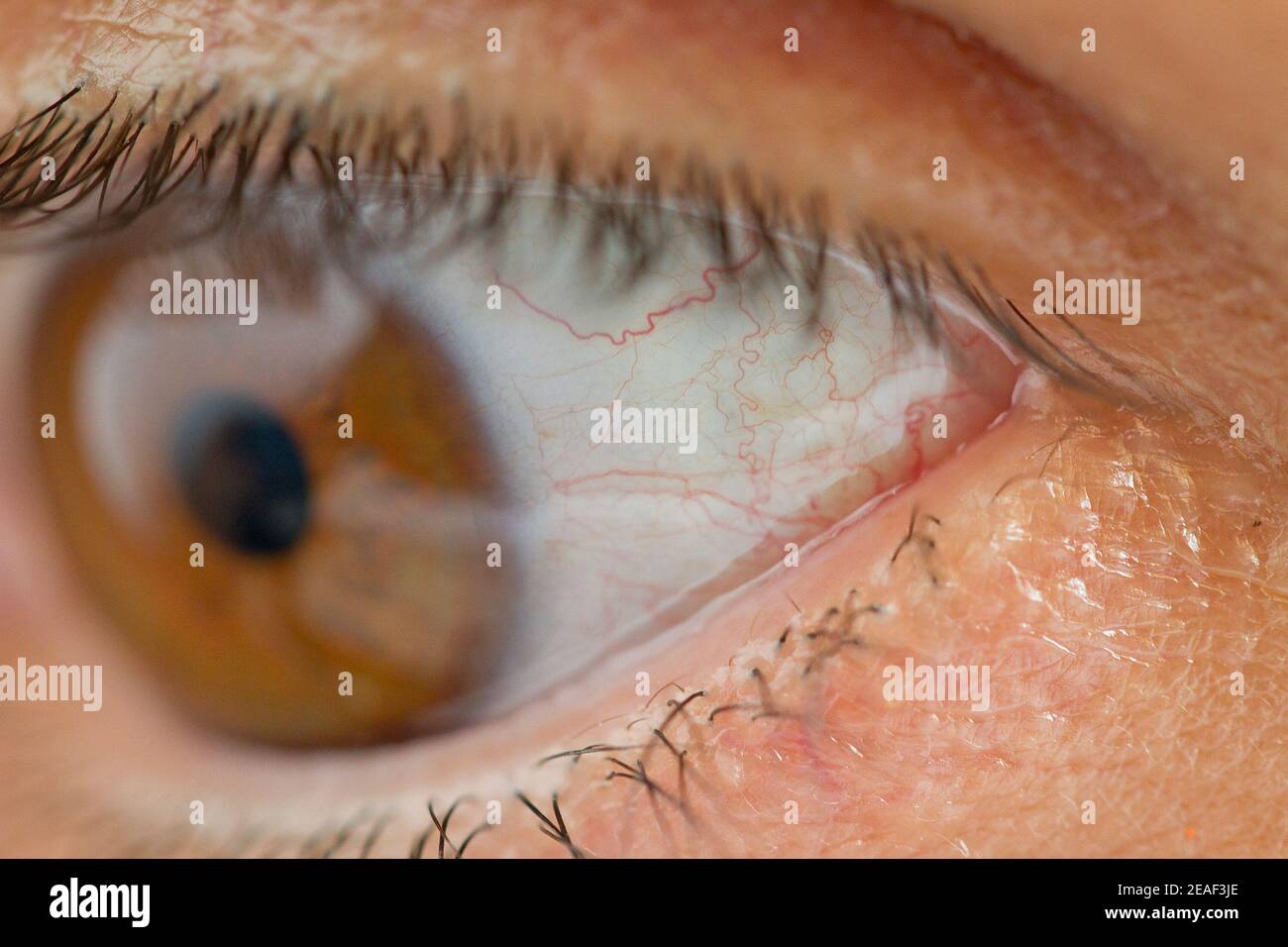 Eye veins Banque de photographies et d’images à haute résolution - Alamy