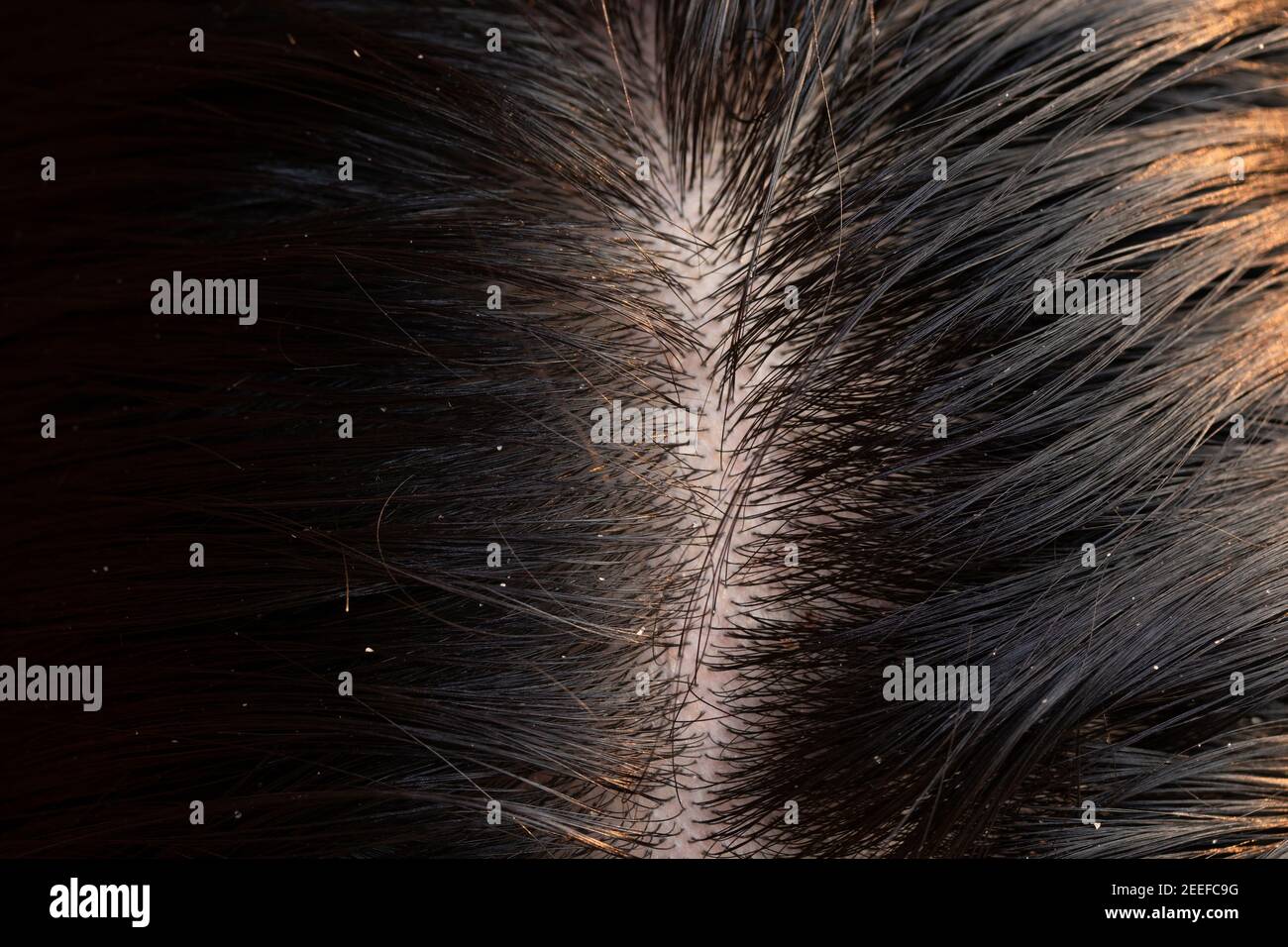 Un homme avec des pellicules dans les cheveux sombres, vue de dessus ...