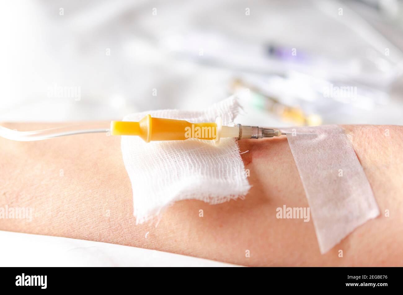 Injection intraveineuse. La perfusion est intraveineuse. Premiers soins ...