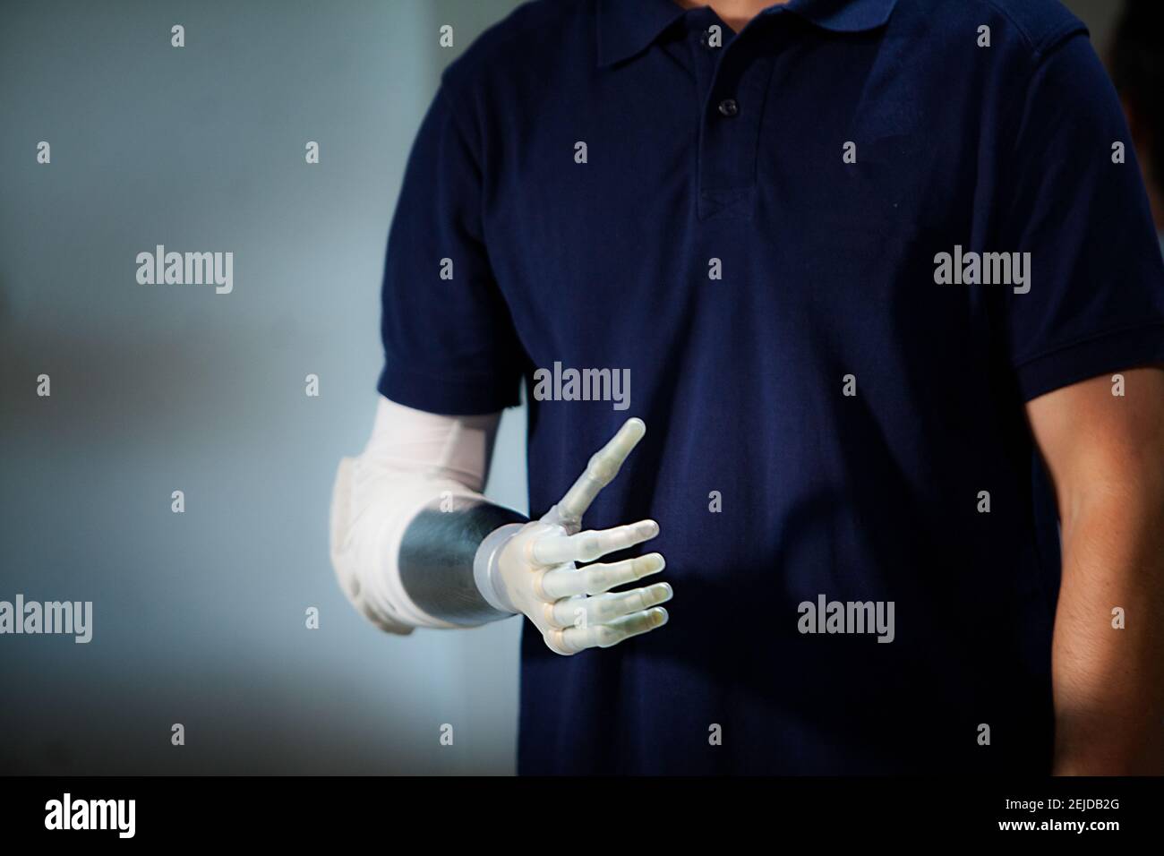 Une main bionique Banque de photographies et d’images à haute ...