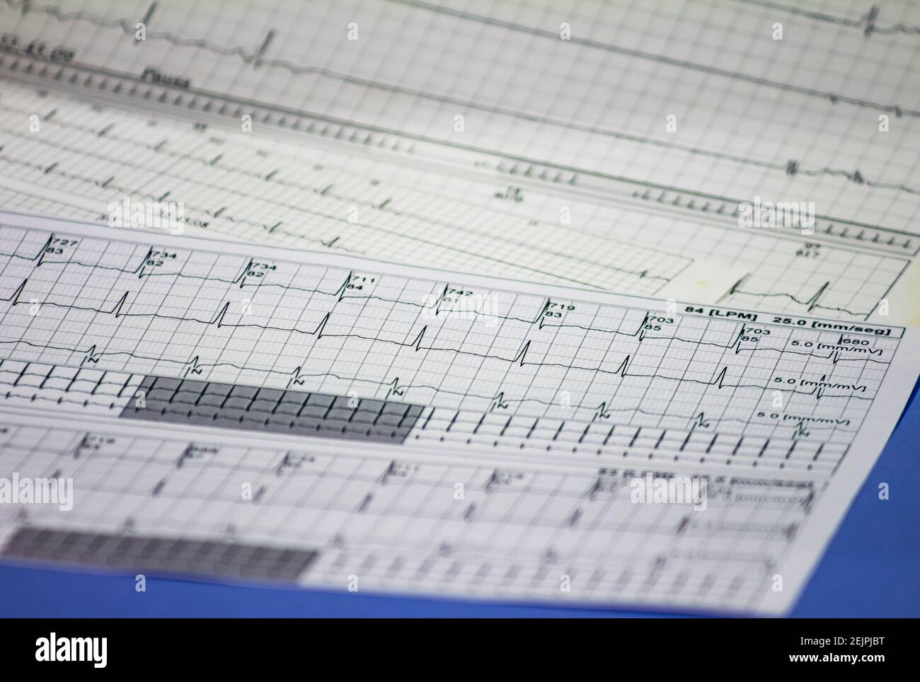 Diagrama de ekg Banque de photographies et d’images à haute résolution ...
