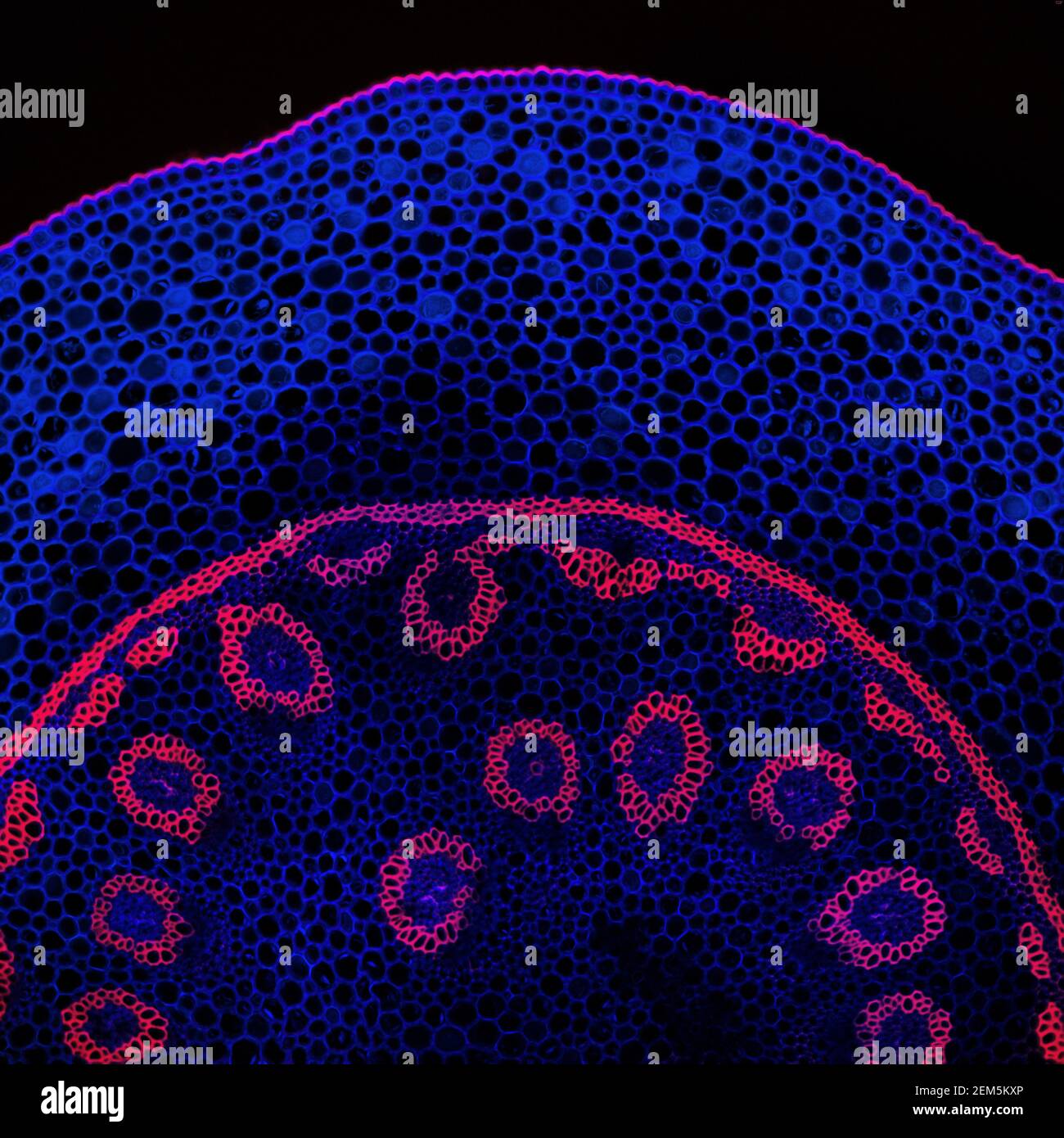 Échantillon microscopique de plantes Convallaria, signal de ...