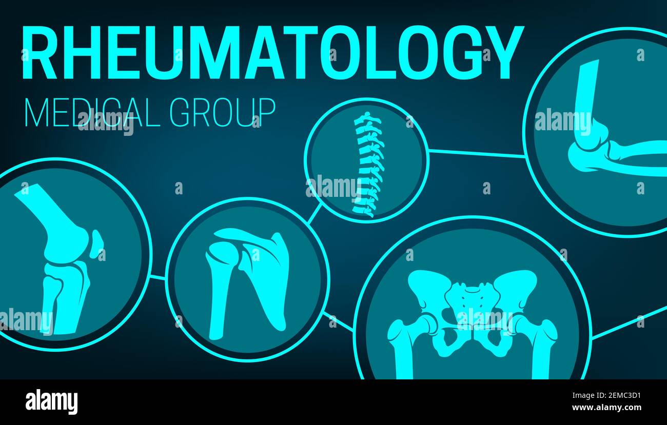 Rheumatologie médecine, joints xray, rhumatismal médical soins de santé ...