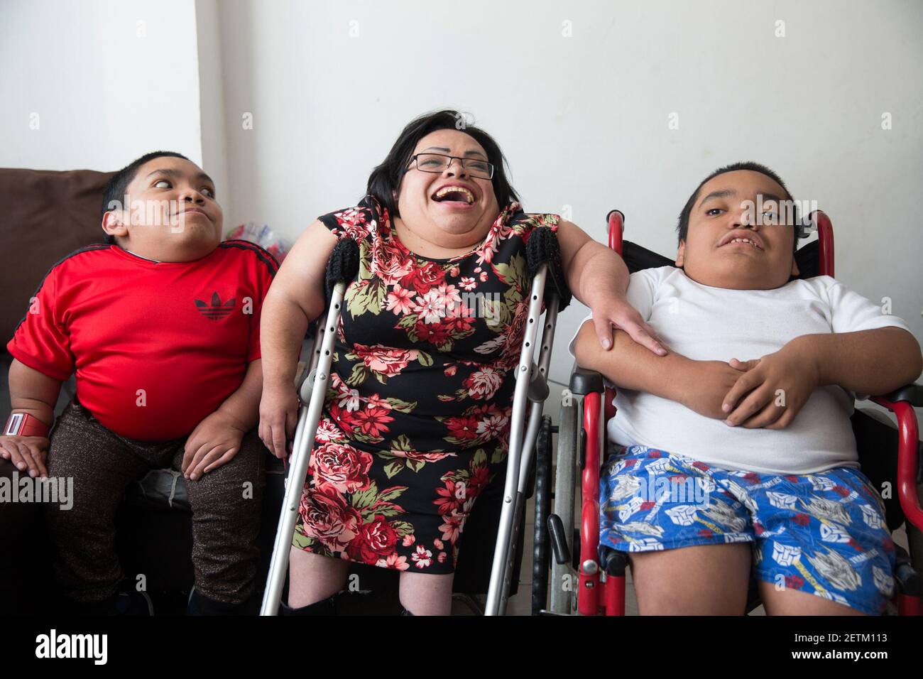 Morquio syndrome Banque de photographies et d’images à haute résolution ...