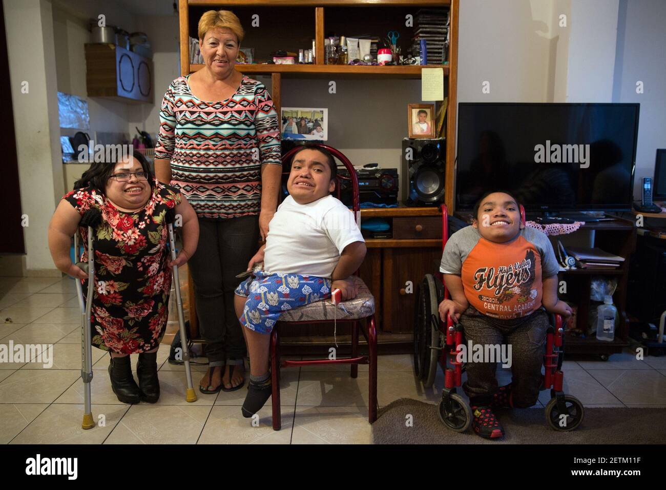 Morquio syndrome Banque de photographies et d’images à haute résolution ...