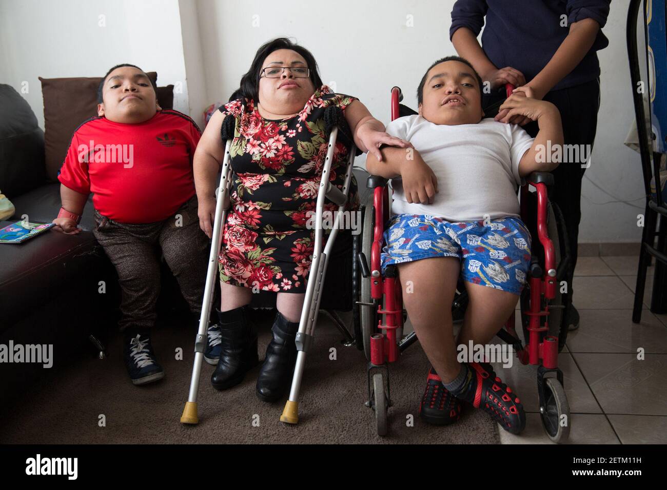 Morquio syndrome Banque de photographies et d’images à haute résolution ...