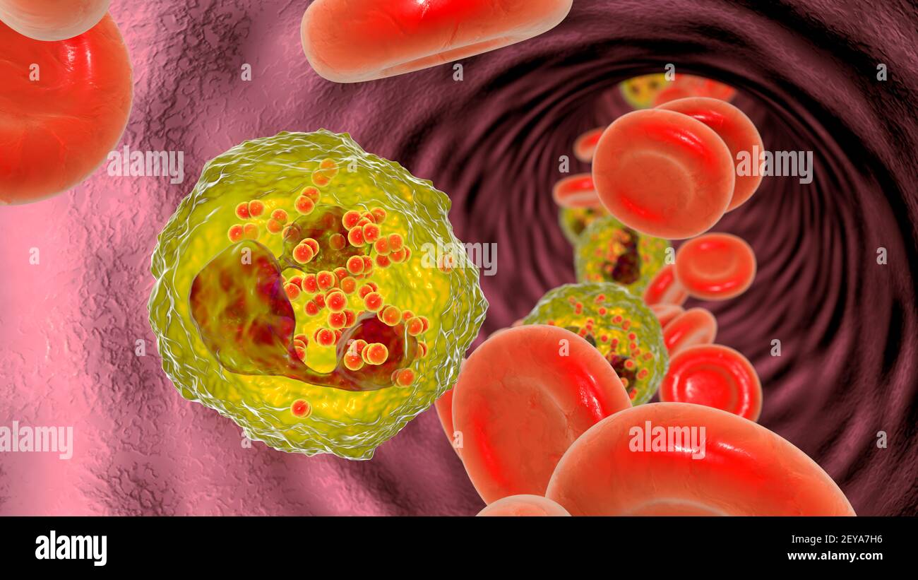 Neisseria meningitidis gram Banque de photographies et d’images à haute ...