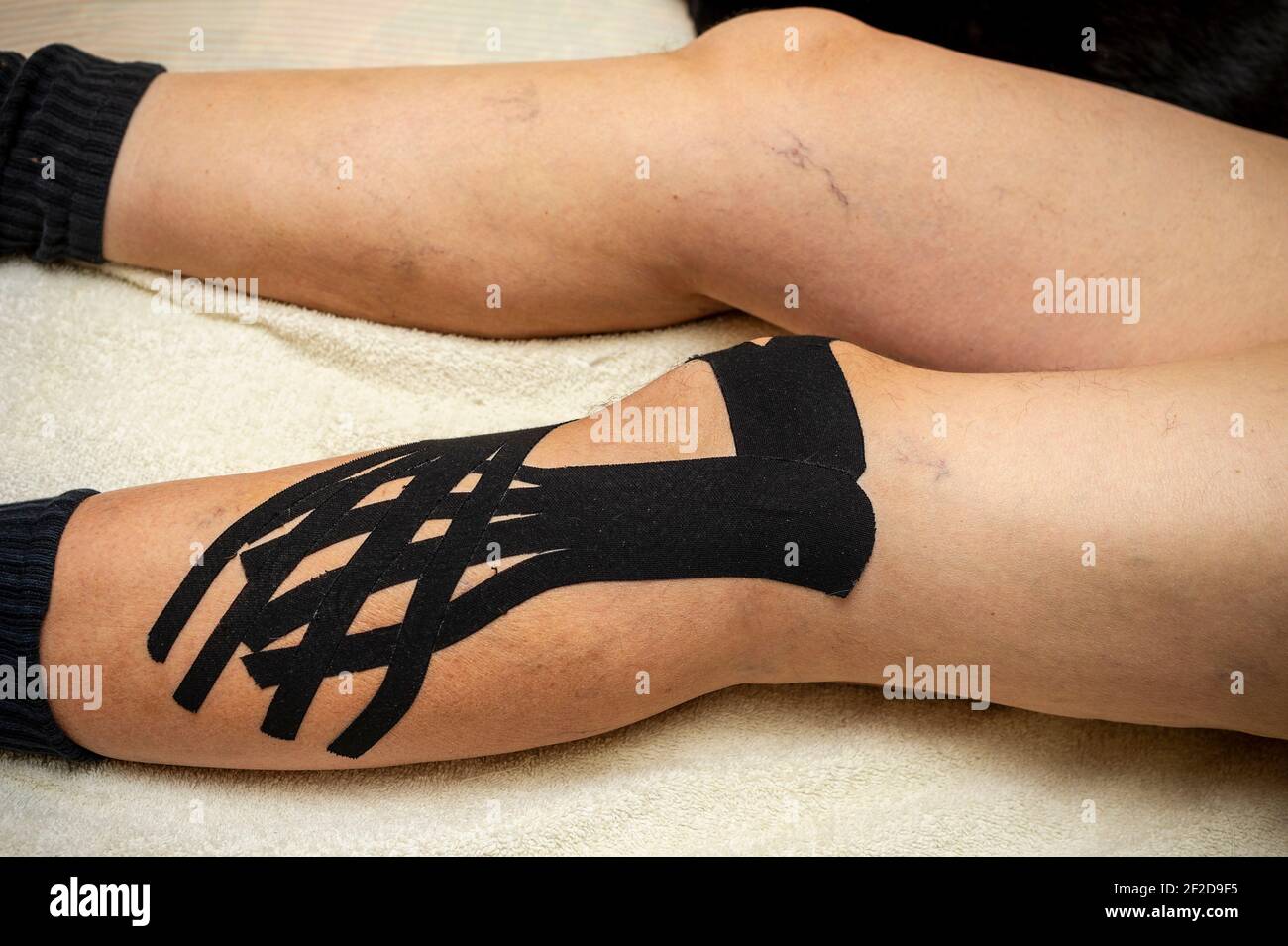 Un patient porte des rubans Kinesio, appliqués par un physiothérapeute ...