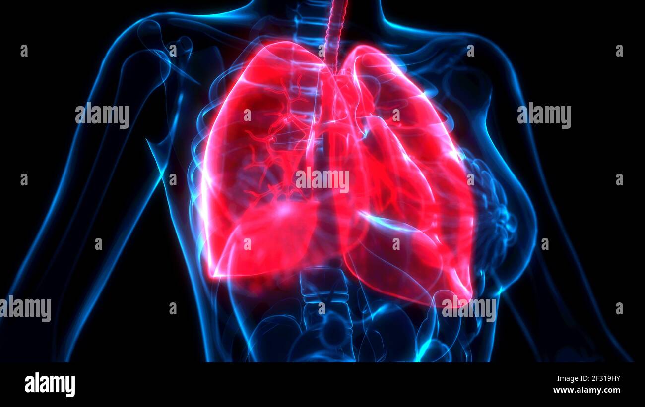 maladie des poumons sur l'acquisition radiographique, illustration ...