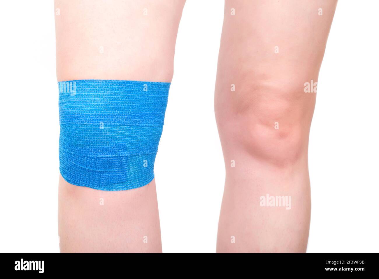 Bandage élastique bleu sur l'articulation du genou pour fixer la plaie ...
