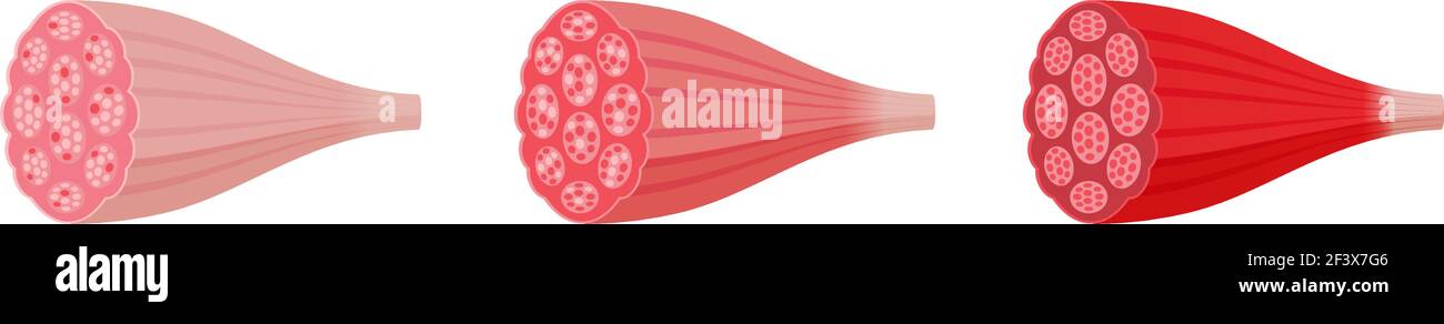 Tipos mixtos Banque d'images vectorielles - Alamy