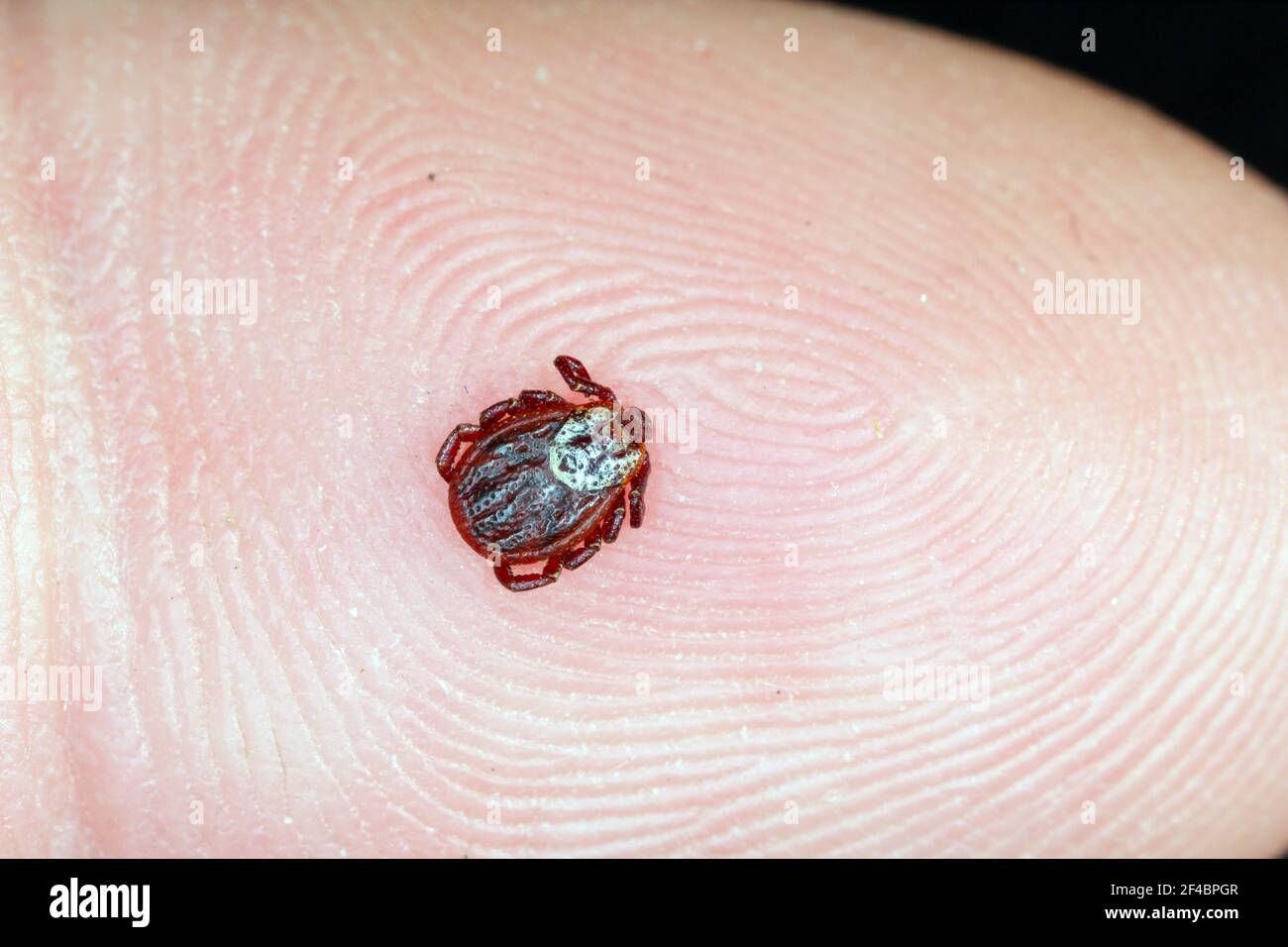 Infestation par les tiques Banque de photographies et d’images à haute ...