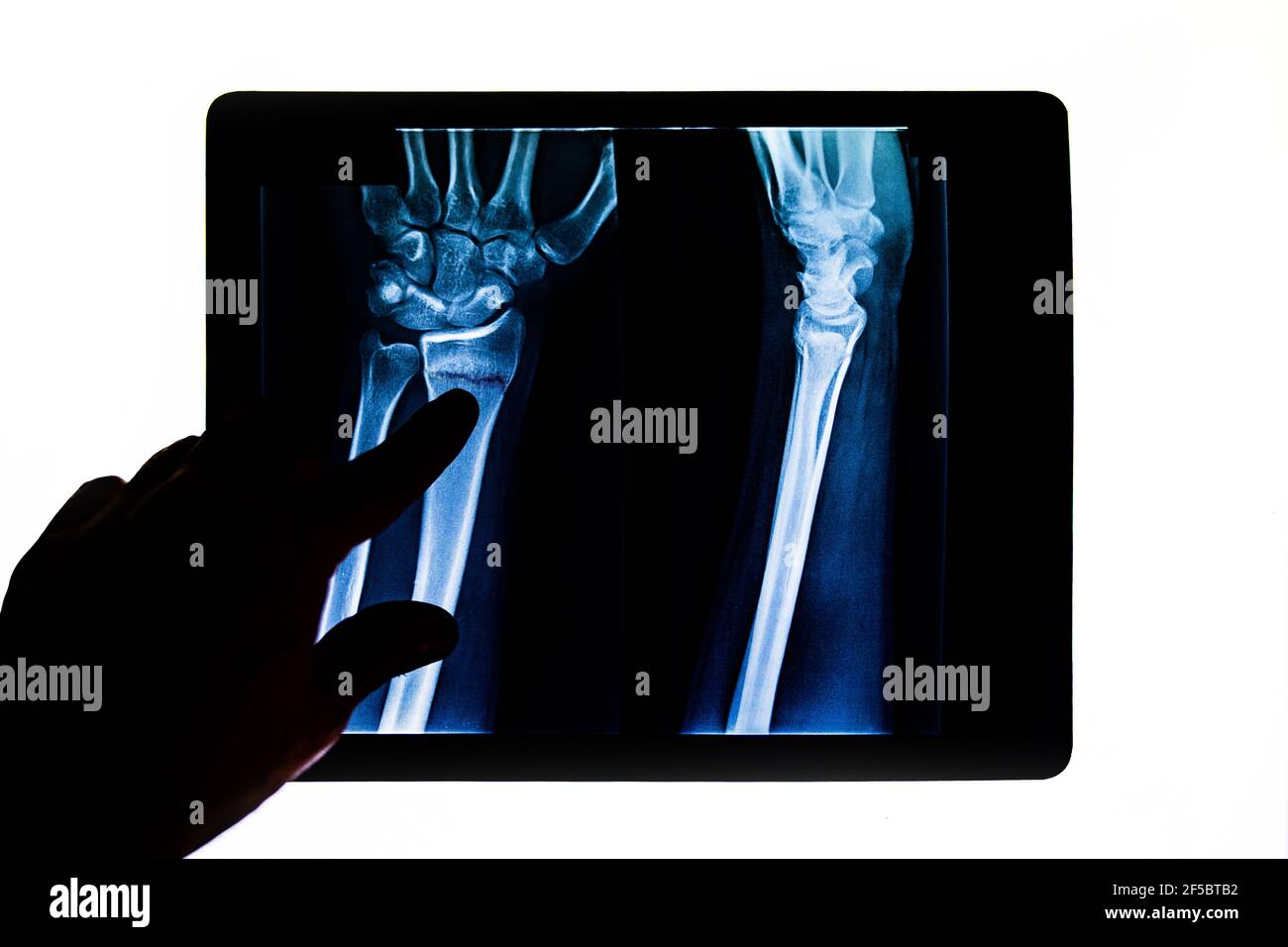 Chirurgie aux rayons x Banque de photographies et d’images à haute ...