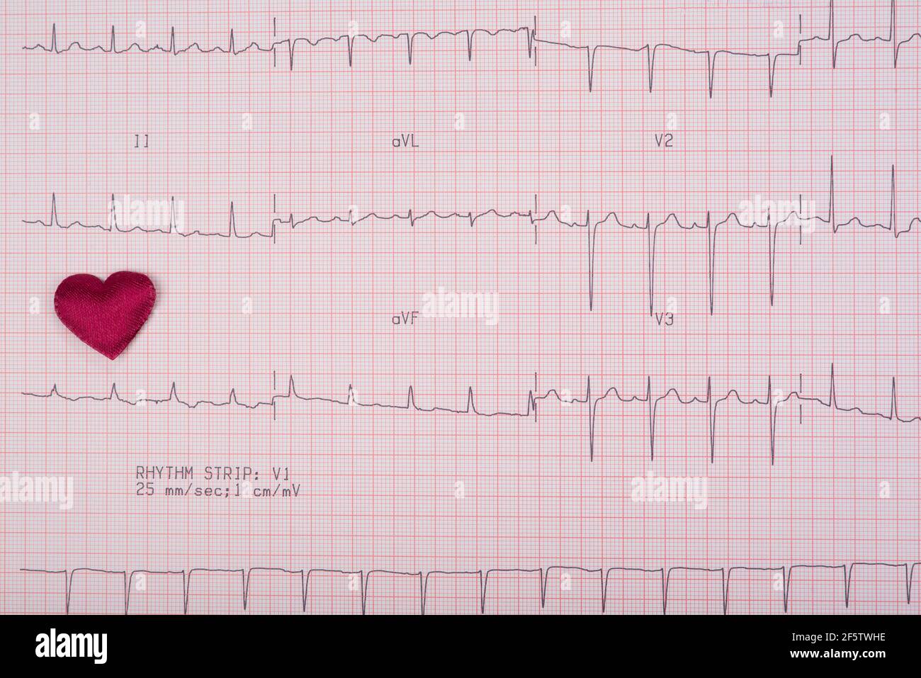 Bande de rythme Banque de photographies et d’images à haute résolution ...