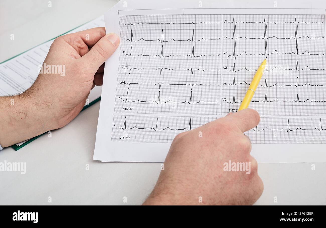 Test de cardiogramme, gros plan du rapport ECG. Le médecin analyse les ...